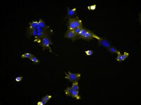 MOC22 Mouse Oral Squamous Cell Carcinoma (OSCC) Cell Line | SCC471